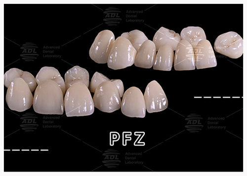 Cases - Advanced Dental Laboratory