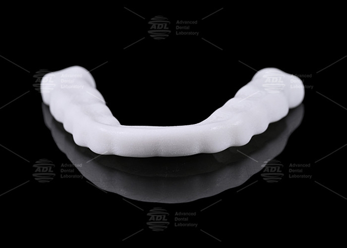 China Dental Lab Top 5 in China Nylon Occlusal Splint