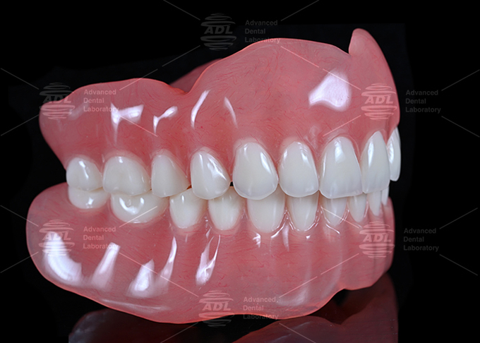 Full Acrylic Denture