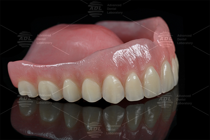 China Dental Lab Top 5 in China Standard Full Denture