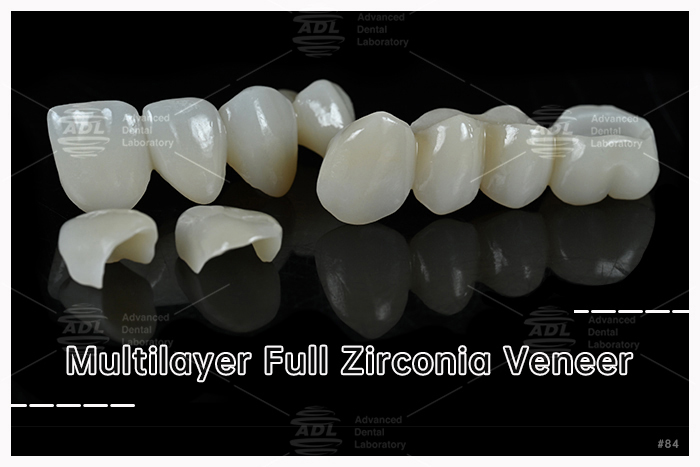China Dental Lab Top 5 in China Multilayer Full Zirconia Veneer