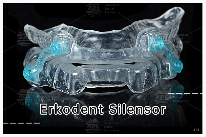 China Dental Lab Top 5 in China Erkodent Silensor