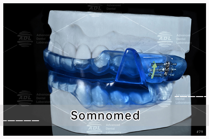 China Dental Lab Top 5 in China Somnomed
