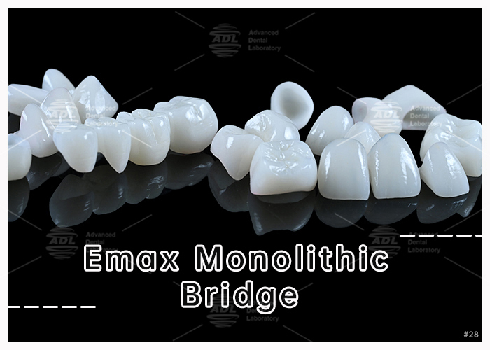 China Dental Lab Top 5 in China Emax Monolithic Bridge