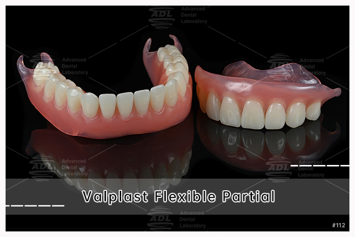 Valplast Flexible Partial