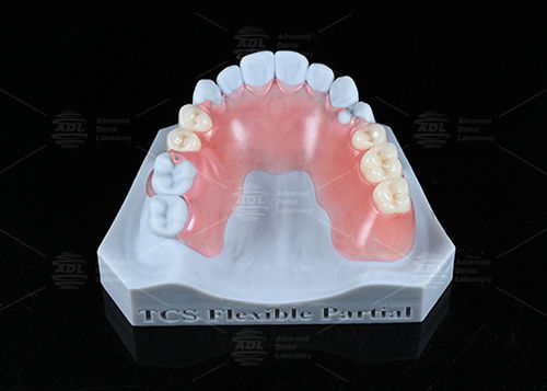 Quality Implant Bar & Flexible Partial factory from China