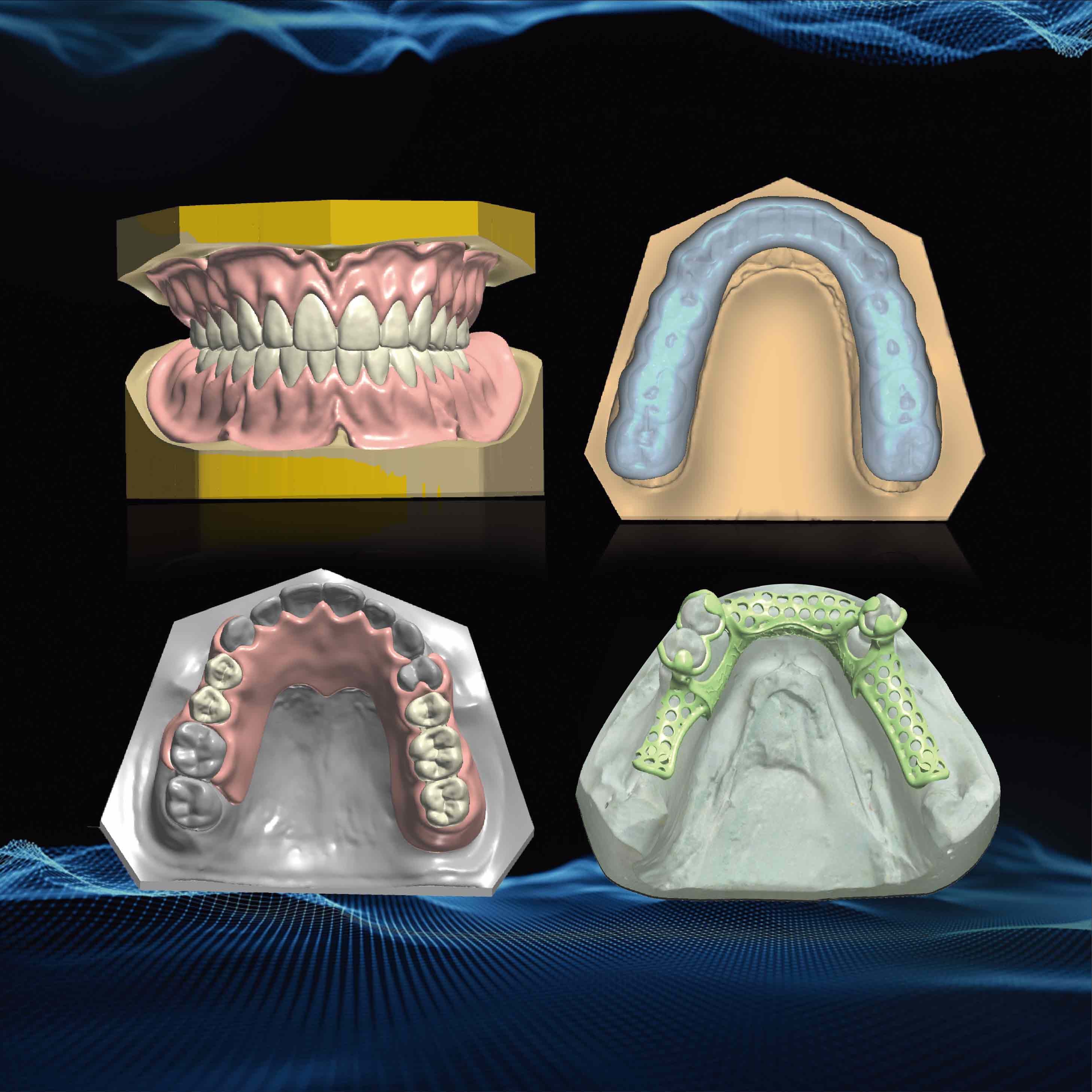 News - Advanced Dental Laboratory