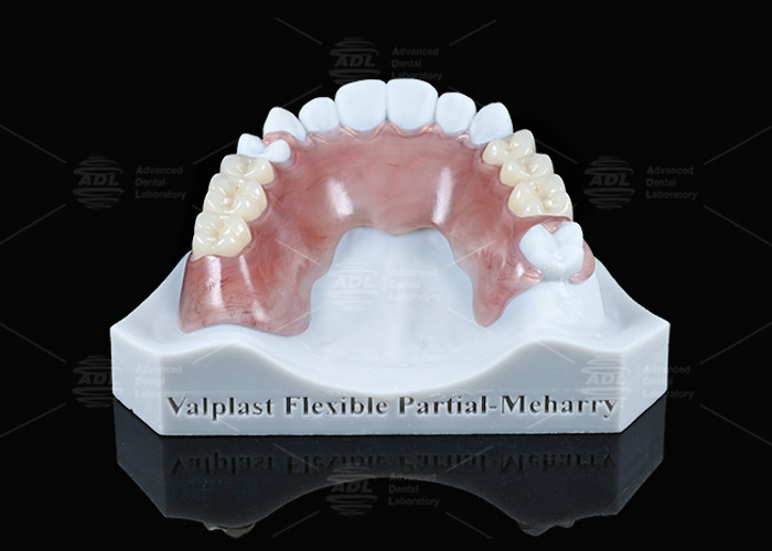 Lightweight Valplast Flexible Partial With Excellent Retention In Pink ...