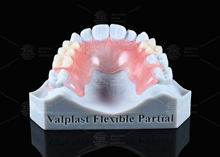 Natural Looking Valplast Partial Denture Longevity Highly Resistant To ...