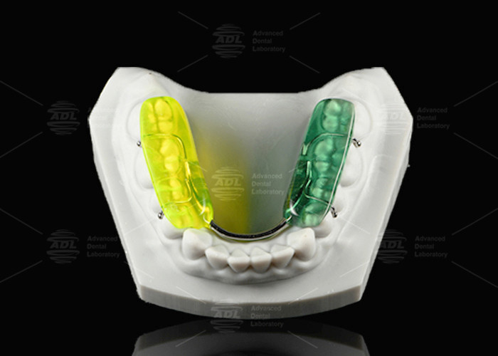 Colorful Gelb Dental Splint Hard Acrylic Resin Occlusal Splint For ...