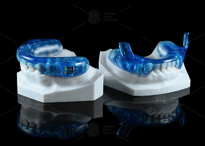 Customizable Dorsal Sleep Appliance Anti Snoring Device For Restful Sleep