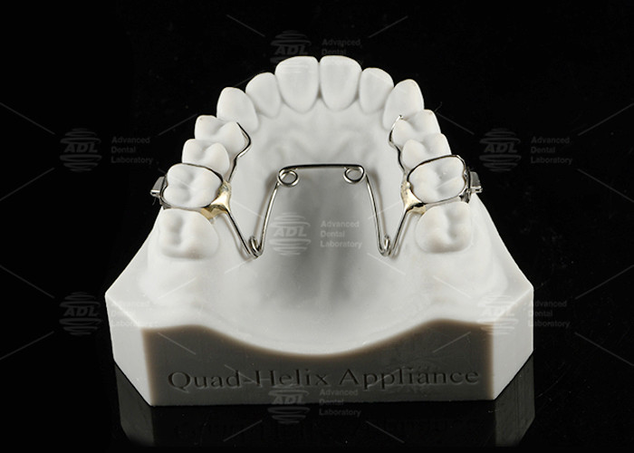 Children And Adolescents Quad Helix Appliance Orthodontics Stainless Steel