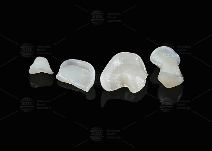 Translucent Onlay Zirconia Inlay For Long Lasting Stain And Wear Resistance