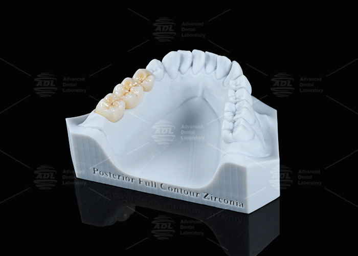 Translucency White Full Contour Zirconia Crown FCZ Monolithic Zirconia ...