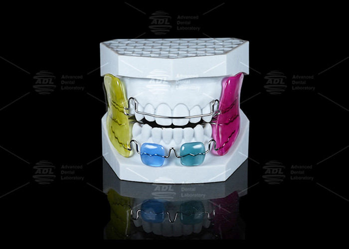 Children And Adults Frankel II Appliance Supporting Occlusion Recovery