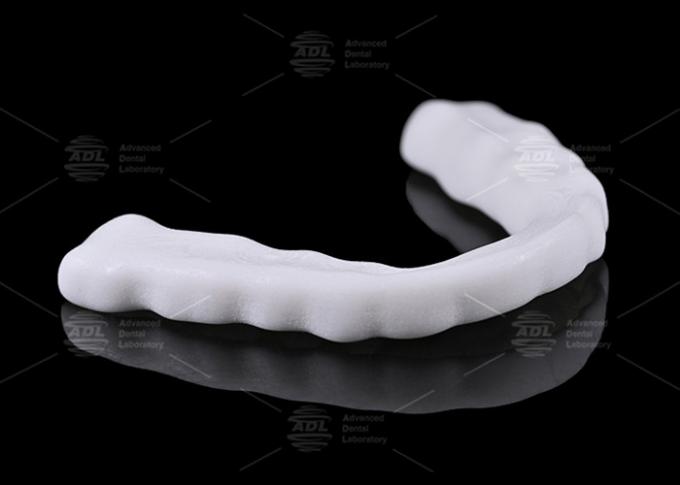 Nylon Occlusal Splint